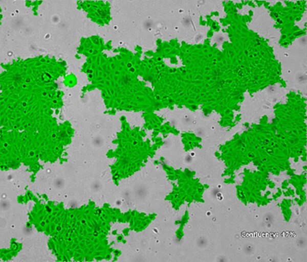 MLM.3 Mouse Lung Metastasis Cell Line | SCC625